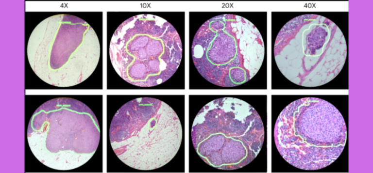 Google's New AI-Powered Microscope Will Be Able To Detect Cancer - Trak ...